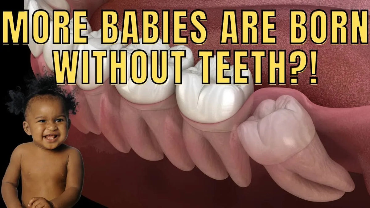 Unbelievable: Babies Born Without Teeth?!? Here's the... – Black Vegan Shop